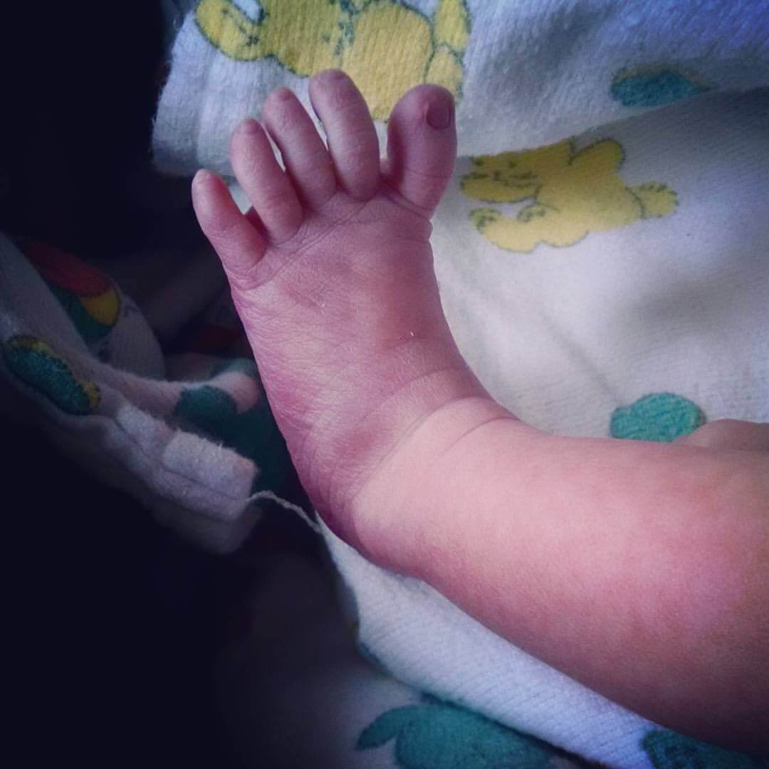 Going forward. And a new baby to love. - vomitingchicken.com